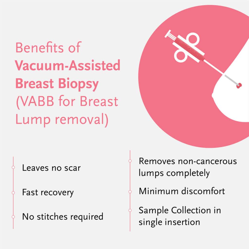 Breast Lump Removal Without Scars: VABB | CK Birla Hospital