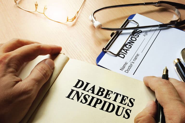 Diabetes Insipidus - CK Birla Hospital