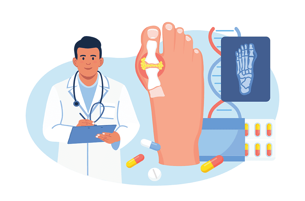 Gout - Causes, Signs, Diagnosis & Treatment | CK Birla Hospital