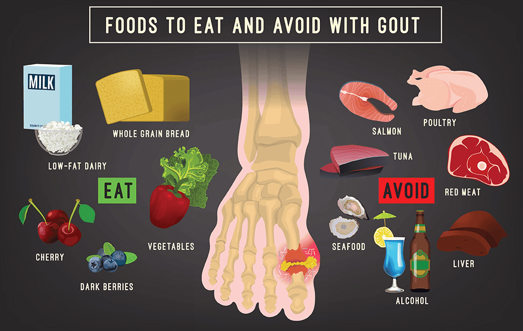 Gout - Causes, Signs, Diagnosis & Treatment | CK Birla Hospital
