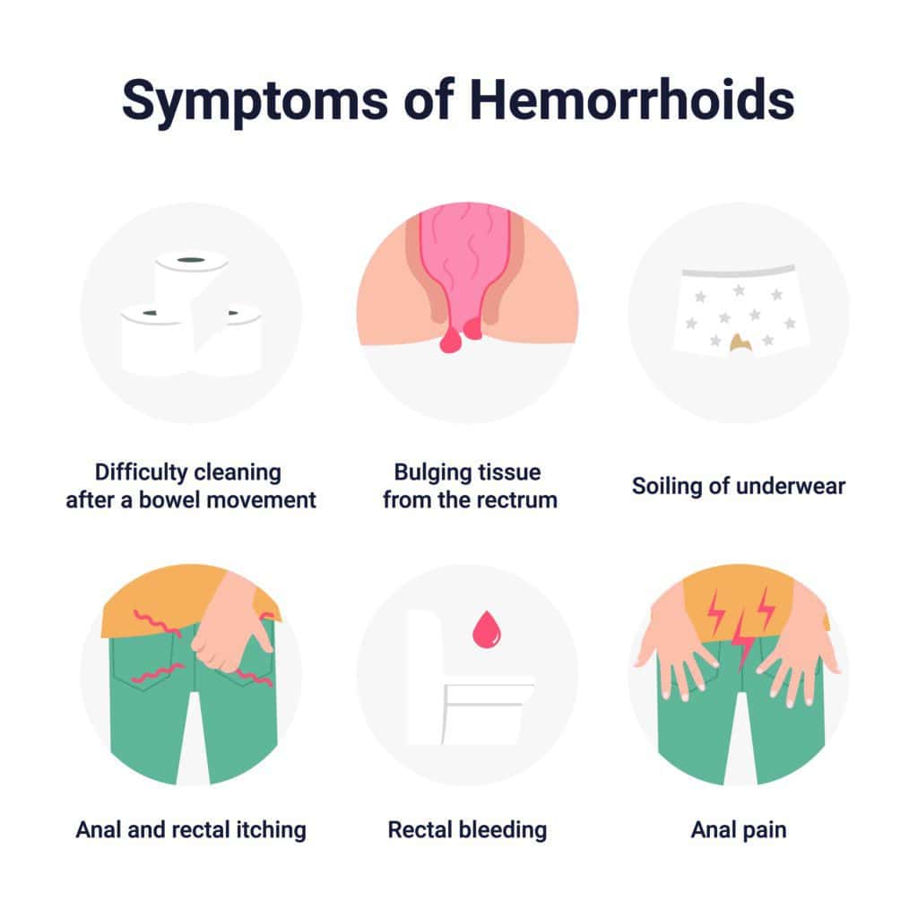 Piles (Haemorrhoids) - Causes, Symptoms, Risk Factors & Treatment | CK Birla Hospital