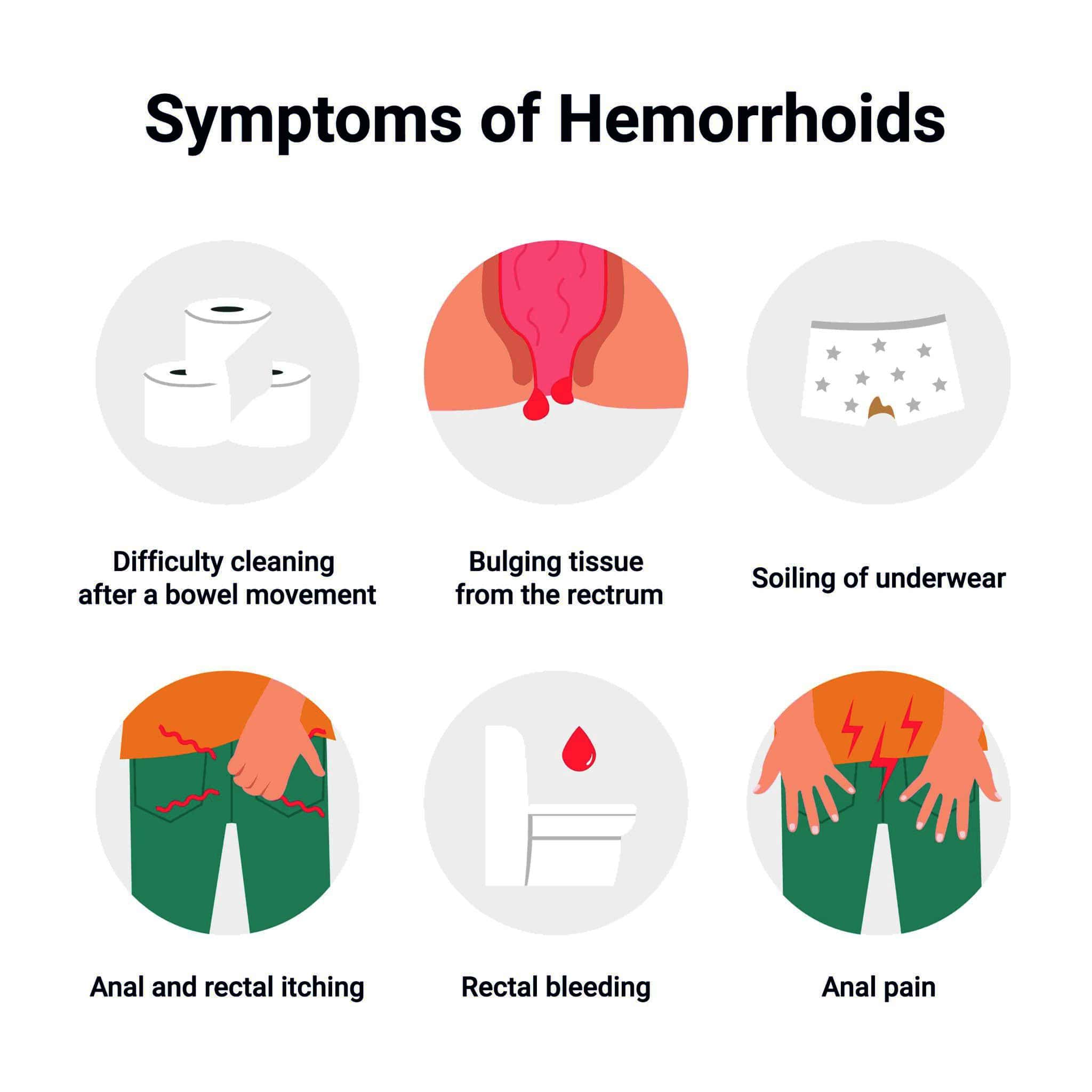 Piles (Haemorrhoids) - Causes, Symptoms, Risk Factors & Treatment | CK Birla Hospital